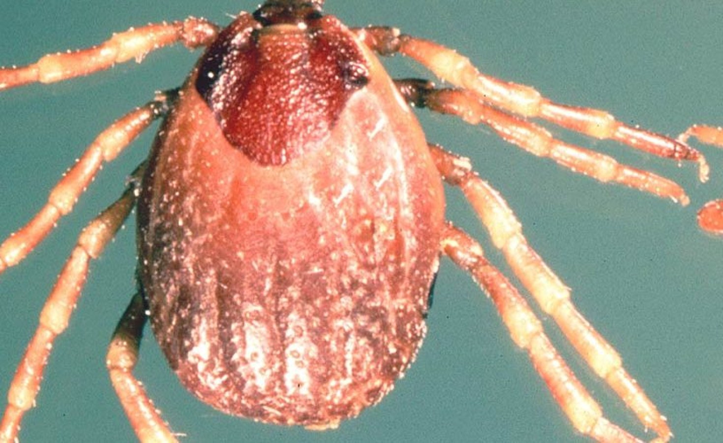 Namibia Confirms Outbreak of Deadly Congo Fever - allAfrica.com