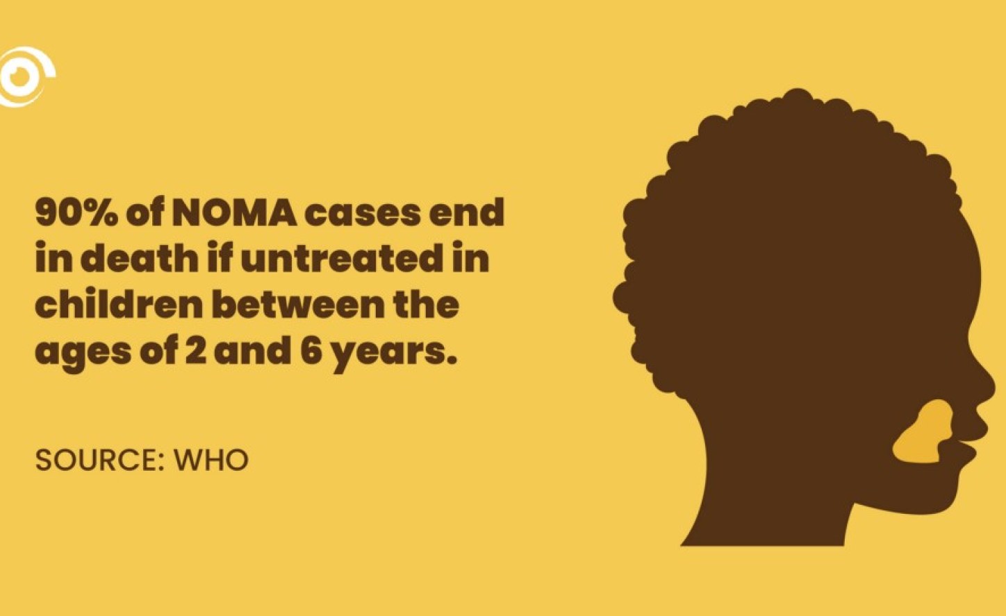 Nigeria: Keeping Noma Under Control - Why Nigeria Must Not Lose ...